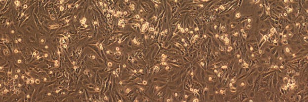 Sorting iPSC derived Cardiomyocytes using the SH800 Cell Sorter